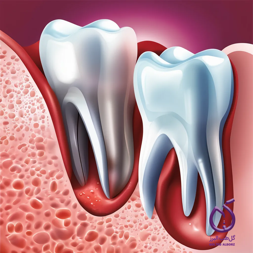 شرکت گل طب البرز | پروتکل‌های نوین احیای پالپ و بازسازی بافت دندانی: از ...